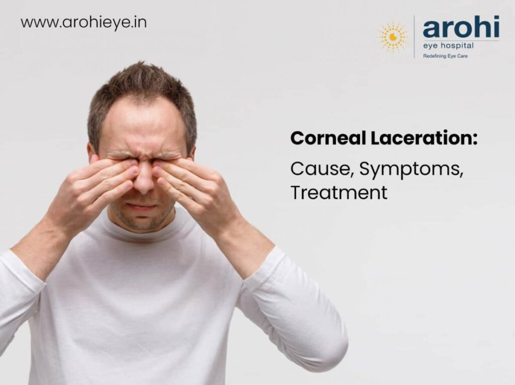 Corneal Laceration: Cause, Symptoms, Treatment