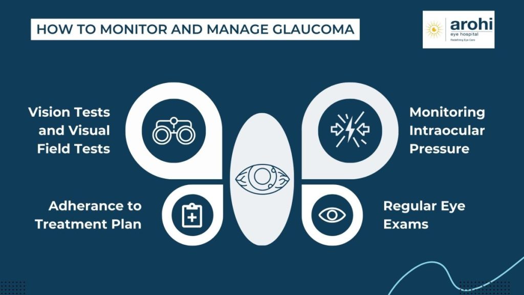 How to Prevent Glaucoma 2023: A Comprehensive Guide