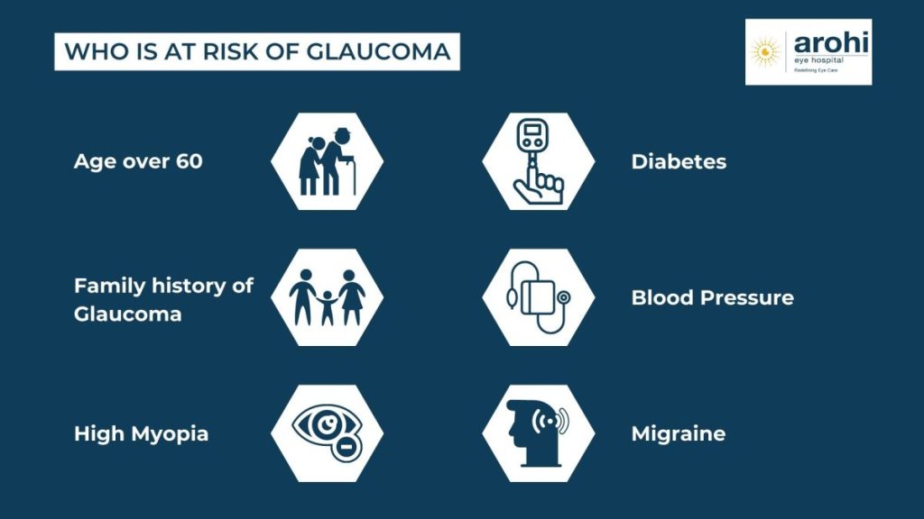 How to Prevent Glaucoma 2023: A Comprehensive Guide