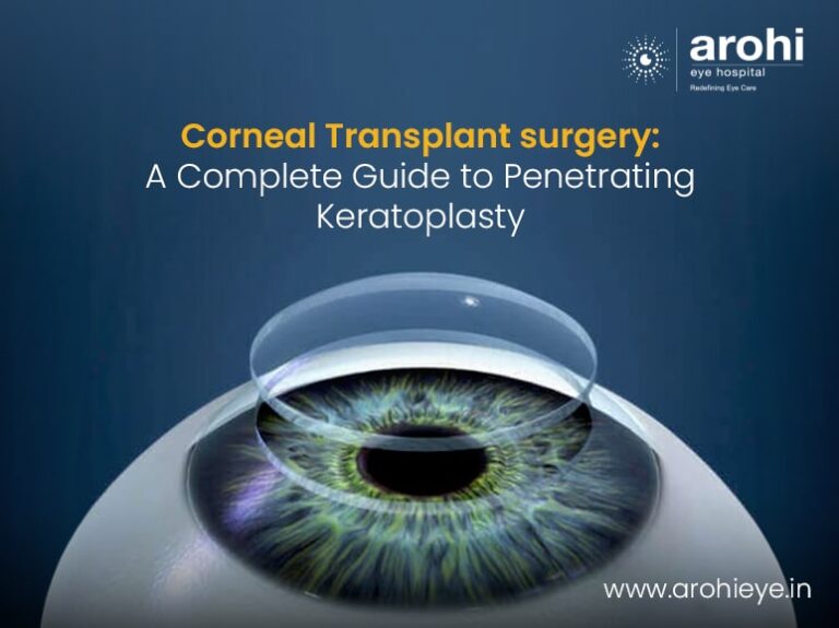 Corneal Transplant surgery: A Complete Guide to Penetrating Keratoplasty