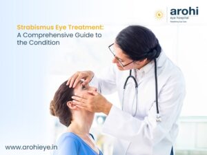 Understanding Strabismus Eye Treatment: A Complete Guide