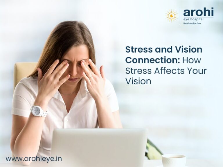 Stress and Vision Connection: How Stress Affects Your Vision