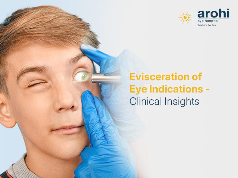 Evisceration of Eye Indications – Clinical Insights